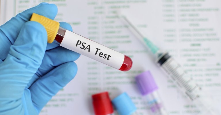 What does elevated Prostate-specific antigen (PSA) actually show?